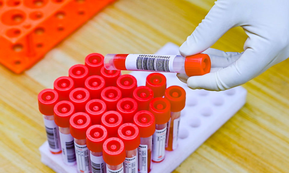 Is there an End to all these Nucleic Acid tests? For some, Maybe | The ...