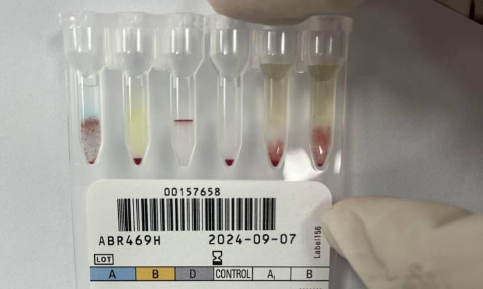 1st Ever Case of Staggeringly Rare Blood Type Found in Zhenjiang | The ...